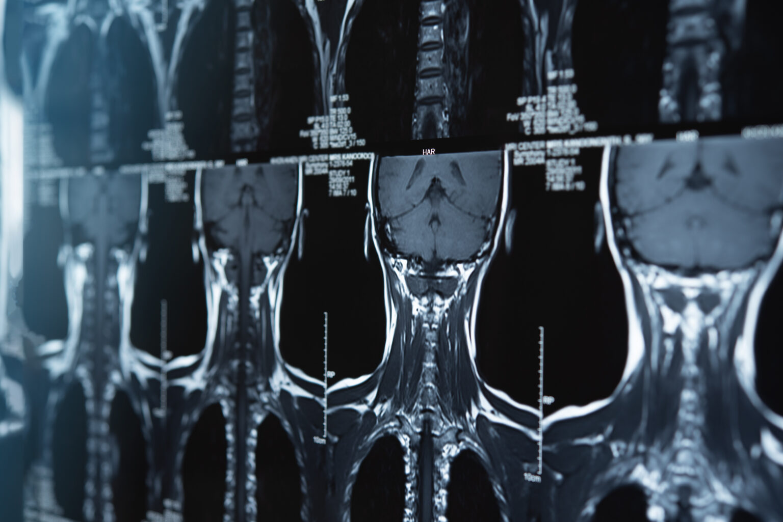 Understanding Your MRI Report | TaylorMed MRI