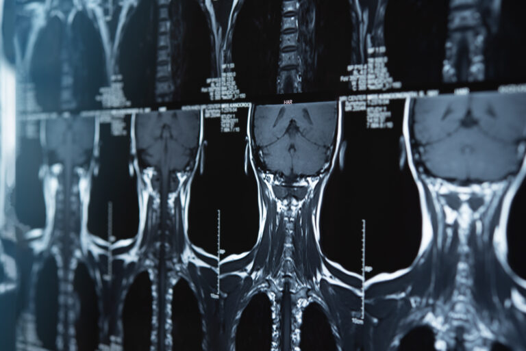 Understanding Your MRI Report | TaylorMed MRI